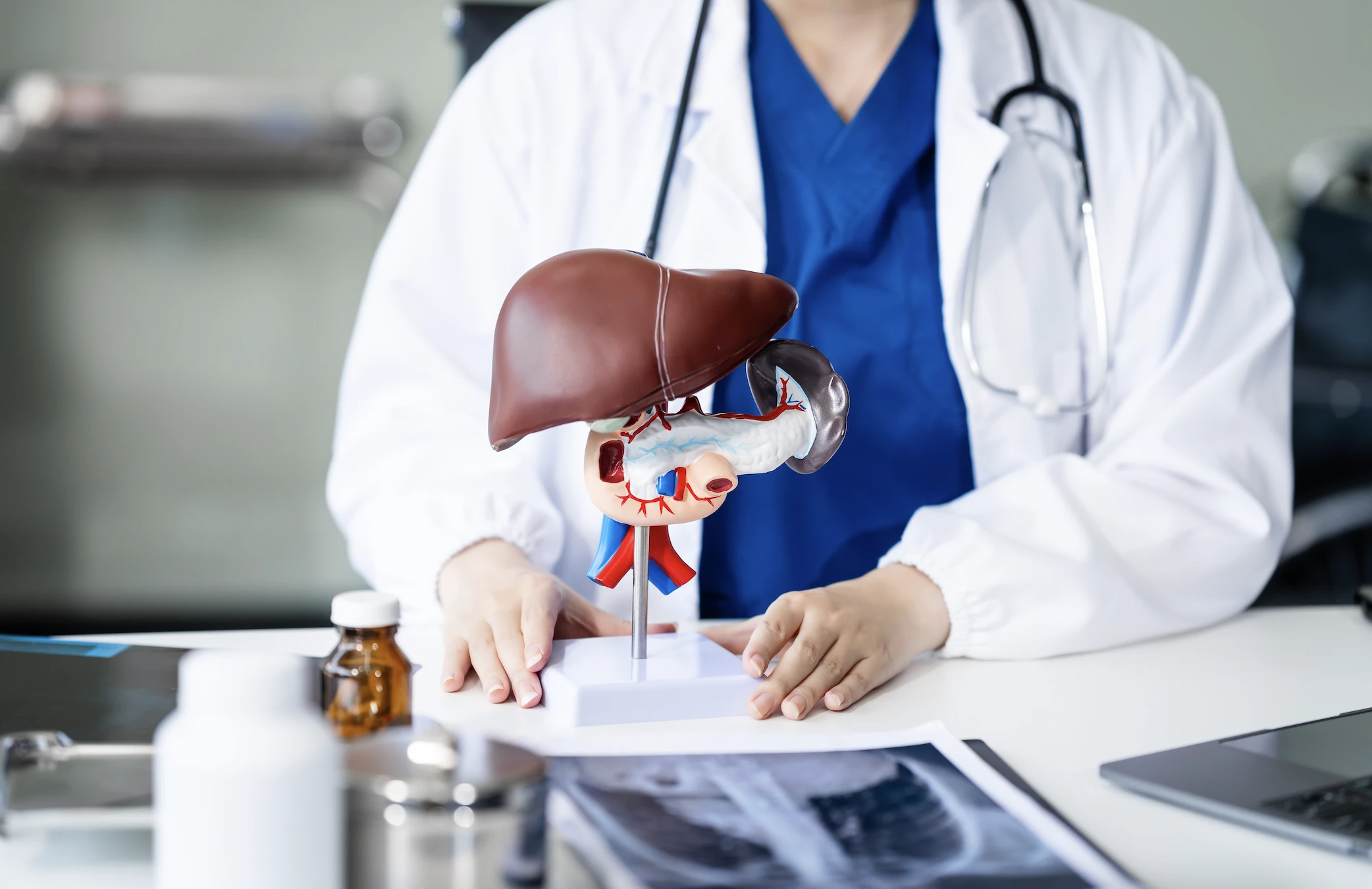 Portal Vein Thrombosis as a Complication of COVID-... | proLékaře.cz