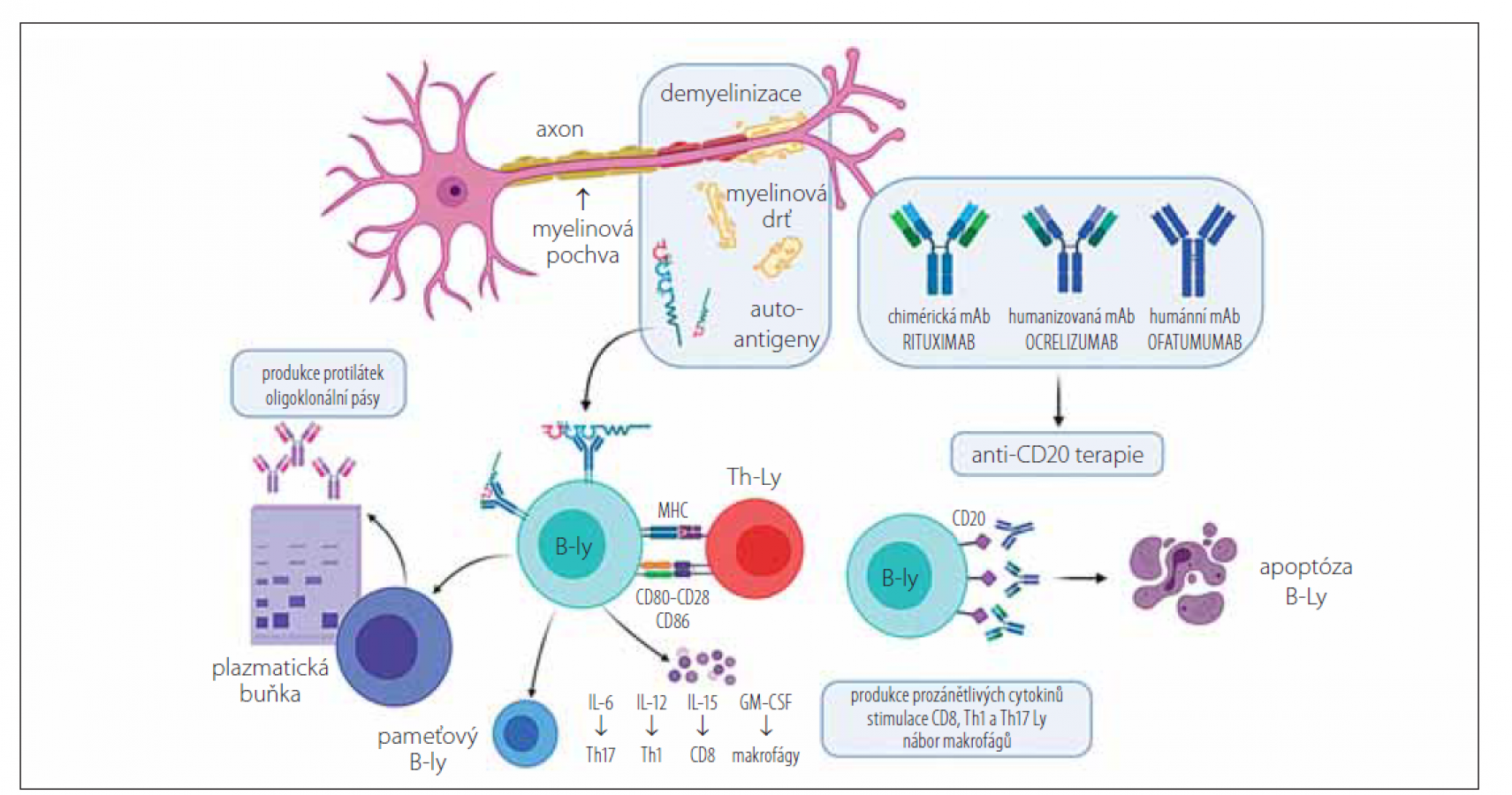 Ofatumumab – a new high-efficacy treatment for rel... | proLékaře.cz