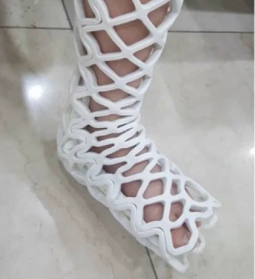 Nový typ fixace umožňuje pravidelnou hygienu konče... | proLékaře.cz