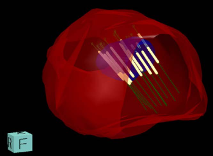 Využití softwarové fúze multiparametrické magnetic... | proLékaře.cz