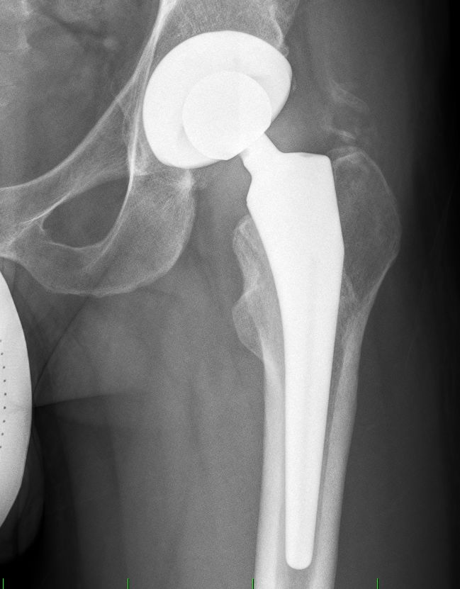 Fixní kombinace diklofenak/orfenadrin versus parac... | proLékaře.cz